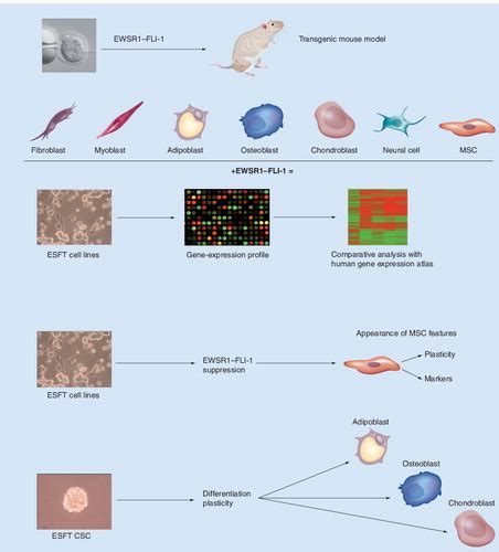 Ewing Sarcoma Histology Diagram