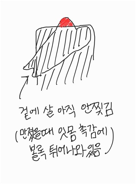 나 윗쪽 사랑니 지금 상태가 이런데 어떻게 생각해 인스티즈instiz 일상 카테고리