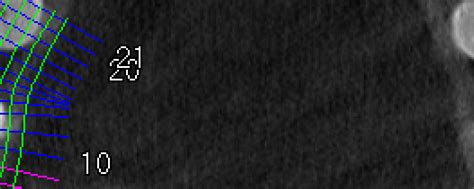 Image Quality In Reporting General Discussions Telerik Forums