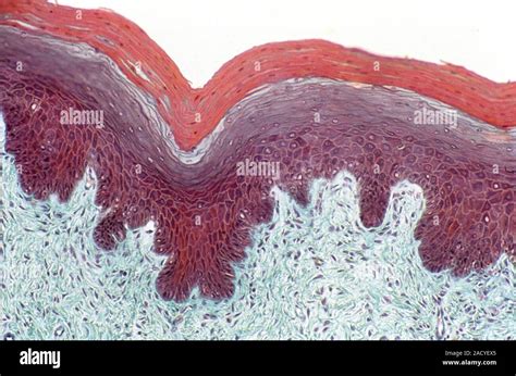 Uterus Light Micrograph Of A Section Through The Ectocervix Region Of