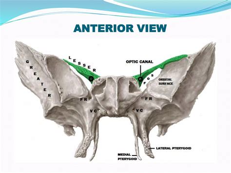 Sphenoid Sinus And Optic Nerve Pptx