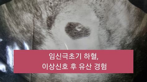 임신 극초기 하혈 임신중 유산 경험 네이버 블로그