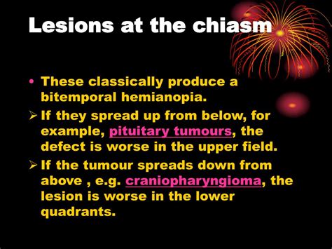 Ppt Visual Field Defects Powerpoint Presentation Free Download Id 1257646