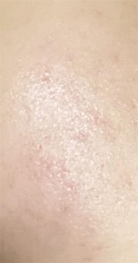 나 피부 진짜 좋아짐 혐주의 언니가 갖고 싶어서 만든 앱 속닥 나 피부 진짜 좋아짐 혐주의 언니가 갖고 싶어서 만든 앱 속닥