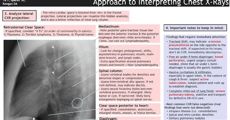 Interpreting Chest X Ray