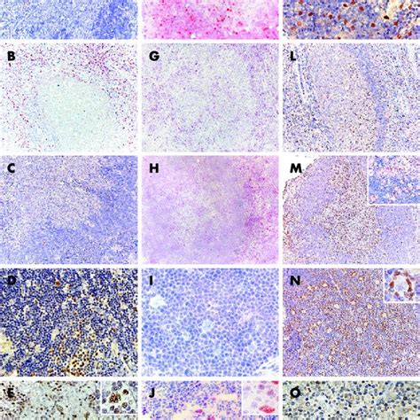 Immunohistochemical Detection Of T Cell Tfs In Thymus A F K