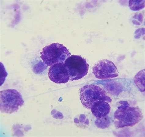 File Mast Cell Tumor Cytology 2  Wikipedia The Free Encyclopedia