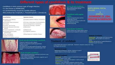 Oral Candidiasis Poster Pptx