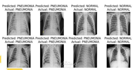 Chest X Ray Pneumonia Classification With Cnn مستقل