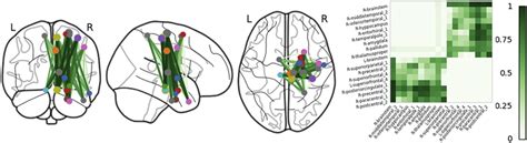 The Disconnected Core Network Is Found By Intersecting The Two Download Scientific Diagram