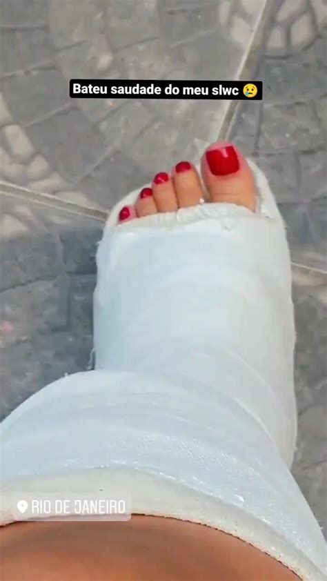 Cast Leg Thisvid Com