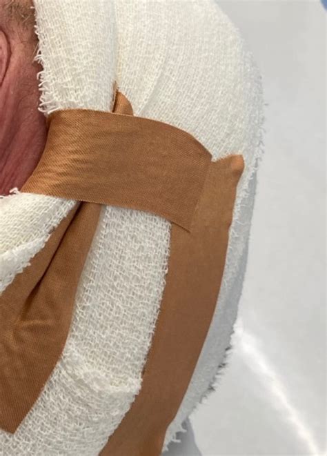 Post Auricular Dressings Dr Sean Flanagan