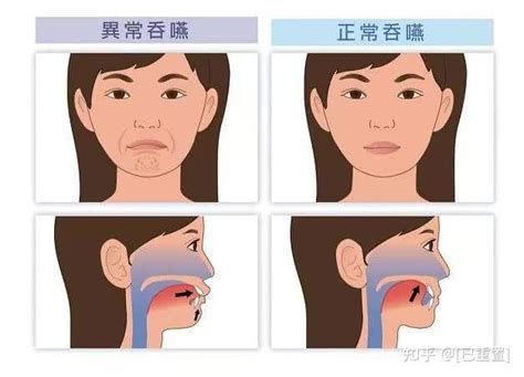 舌头位置放对了，圆脸变瓜子脸？（高能慎入） 知乎