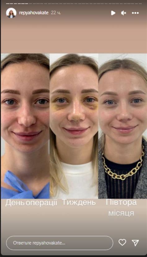 Дружина Віктора Павлика показала як змінилася її зовнішність після