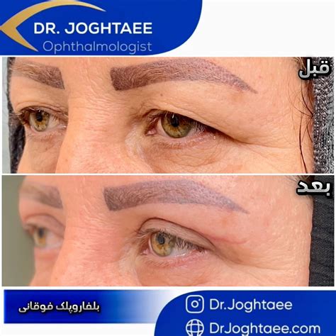 دکتر حسام الدین جغتایی جراح و متخصص بیماری های چشم در ساری