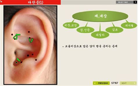 다한증에 좋은 이침요법 네이버 블로그