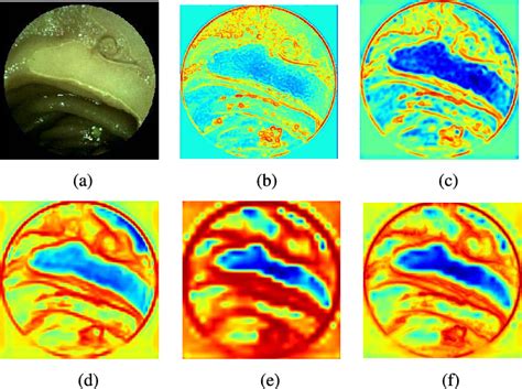 Figure 1 From Hookworm Detection In Wireless Capsule Endoscopy Images With Deep Learning