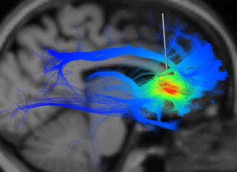 Computational Neuroscience Icahn School Of Medicine