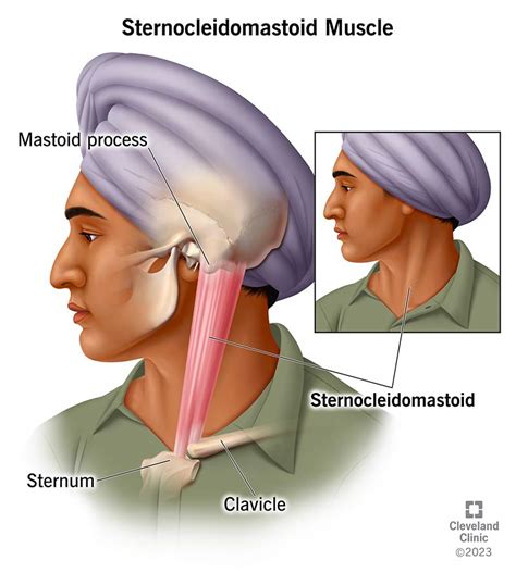 Sternocleidomastoid Trigger Points