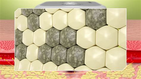 초음파치료기 소노밴드 교육 동영상 Youtube