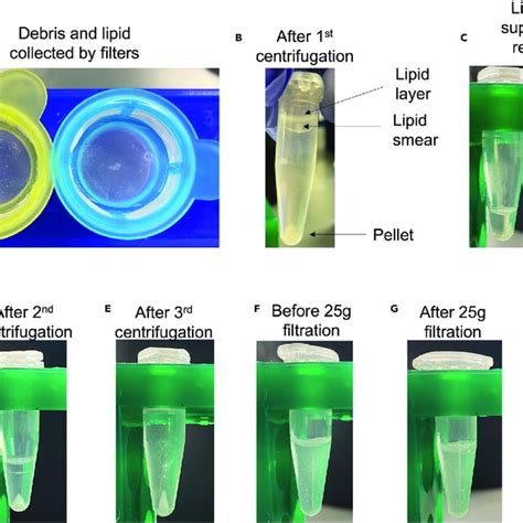 Nuclei Isolation A 100mm Left And 40mm Right Filters After