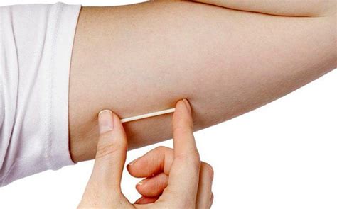 Que Cấy Tránh Thai Có Tác Dụng Ngay Không Và Duy Trì Trong Bao Lâu