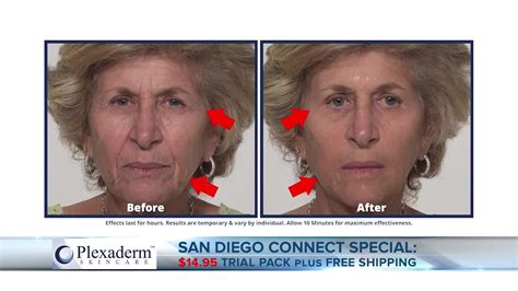 Plexaderm Trial Pack