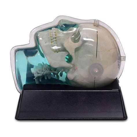 Mri Distortion Phantom For Srs Radiation Products Design Inc