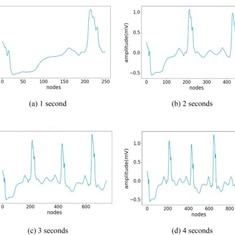 The Ecg Signal Segmentation Samples From 1 To 4 Seconds Download Scientific Diagram