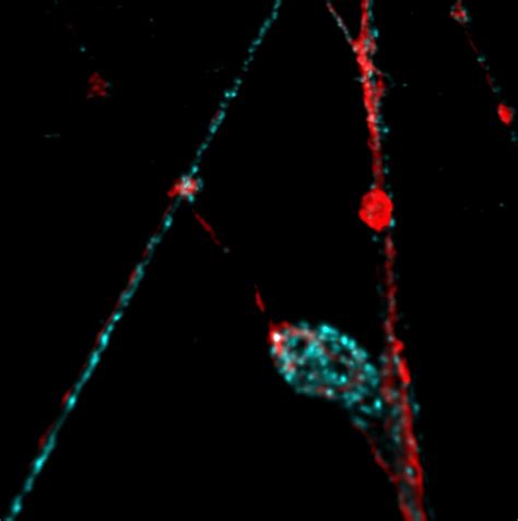 Axonal Regeneration In Motor Neurons Derived From Human Ipscs Crestoptics
