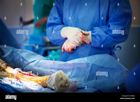 External Fixation Tibia Hi Res Stock Photography And Images Alamy