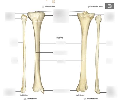 Tibia Diagram Quizlet