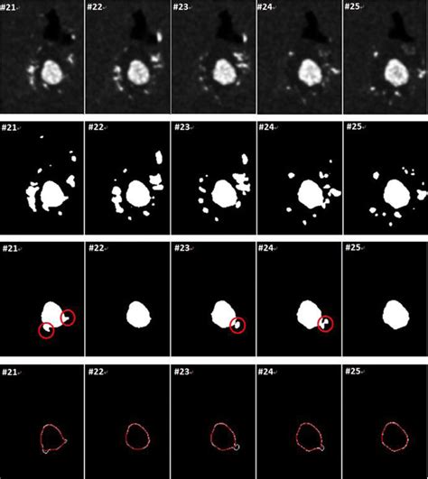 Clean Edge Extraction By The Improved K Nearest Neighbor Filtering
