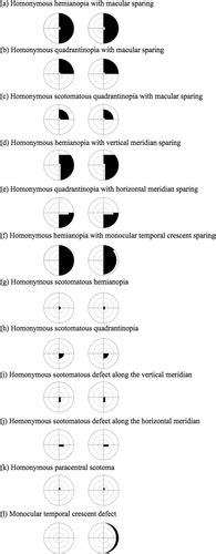 Defect Temporal Crescent