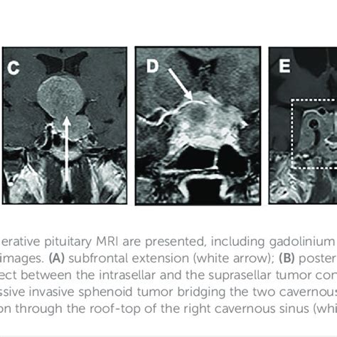 Logistic Regression Model Predicting Surgical Complications Download Scientific Diagram