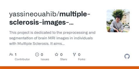 github yassineouahib multiple sclerosis images preprocessing and lesion segmentation this