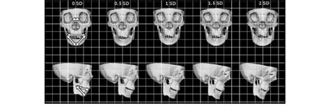 Simulation Of The Third Principal Component Pc3 Craniofacial Download Scientific Diagram