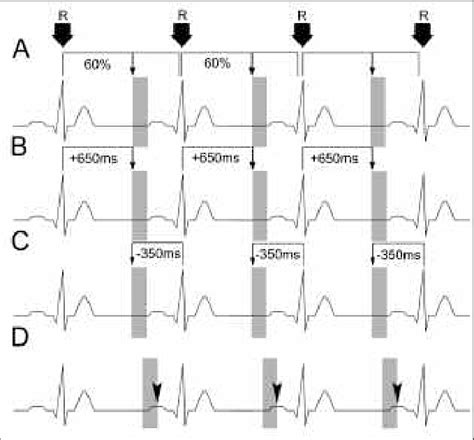 Retrospective Ecg Gating Techniques In The Figure Different Approaches