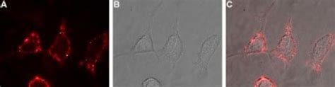 Mglur2 Extracellular Polyclonal Antibody Agc 011 200ul