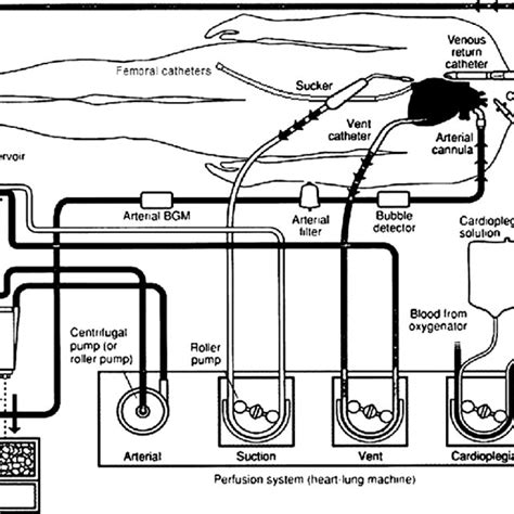 7 Reservoir In Cpb Circuit Download Scientific Diagram