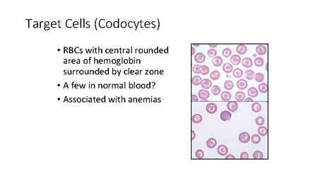 Erythrocyte Morphology Normal Morphology Size Abnormalities Shape