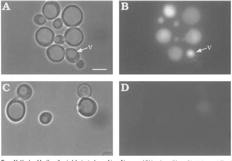 Figure 10 From Synthetic Lethality Screen Identifies A Novel Yeast