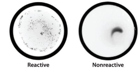 Lab RPR Rapid Plasma Reagin Flashcards Quizlet