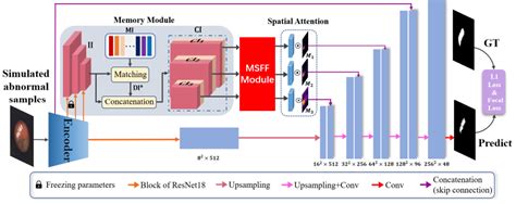 【计算机视觉 异常检测】顶会精选！工业异常检测最新sota方案分享！（上） 计算机视觉 旅途中的宽~ Damo开发者矩阵