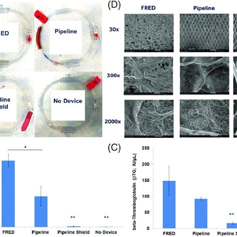 Pdf Thrombogenicity Assessment Of Pipeline Flex Pipeline Shield And