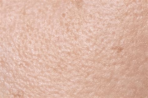 Close Up On Pores Texture Free Photo