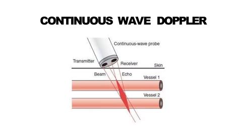 Doppler Physics Ppt PPTX Digital Audio Computer Software And Applications