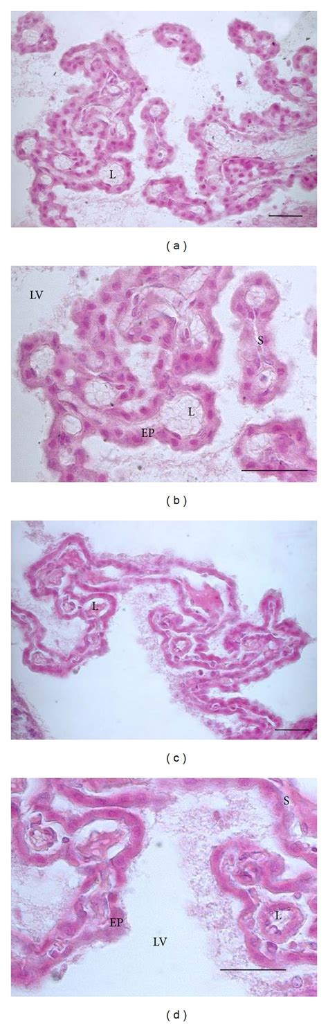 Coronal Sections Of Rats Showing Choroid Plexus Of The Lateral Download Scientific Diagram