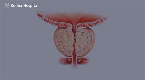 Gabriel Ogbu Posted On Linkedin