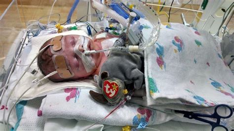 One Of My Many Reasons Why This My Oldest 8 Years Ago Today Just Got Wheeled Out Of His 8 Hour